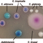 How Fast Does Xifaxan (Rifaximin) Work - Public Health