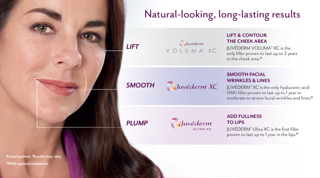 How Long Does Juvederm Products Last? - Public Health