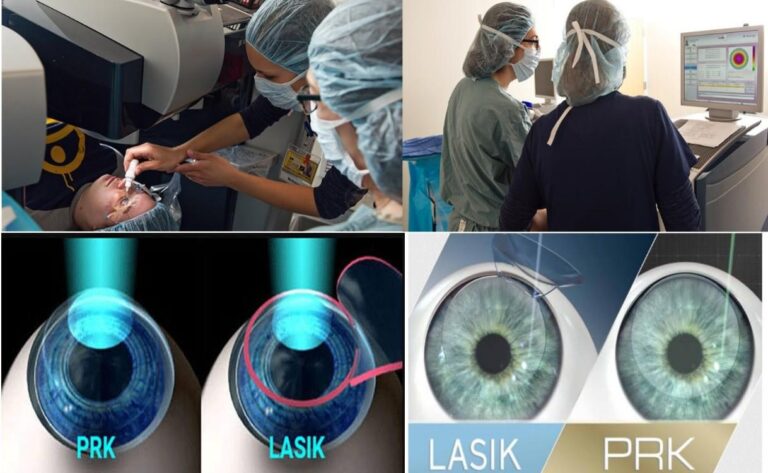 PRK Vs LASIK: Advantages, Disadvantages, Differences, Similarities ...