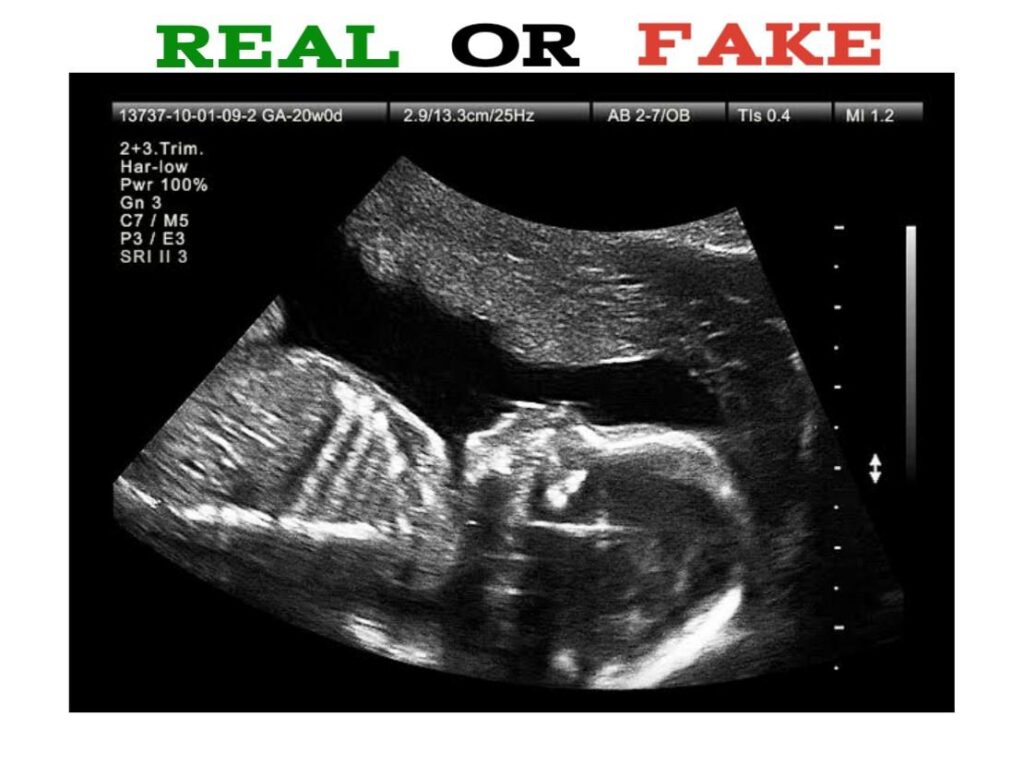 How to Spot Fake Ultrasound Picture - Public Health
