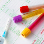What Does Mop Mean On A Drug Test? - Public Health
