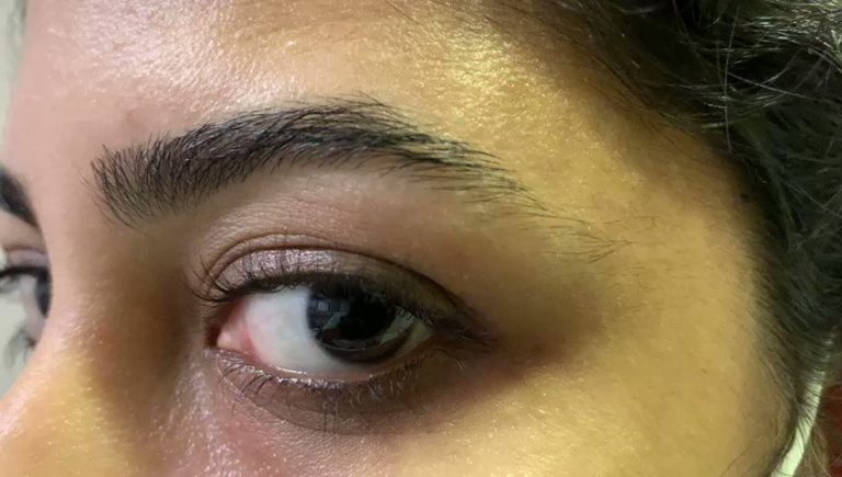 How and Why They Perform The Horizontal Gaze Nystagmus (HGN) - Public ...