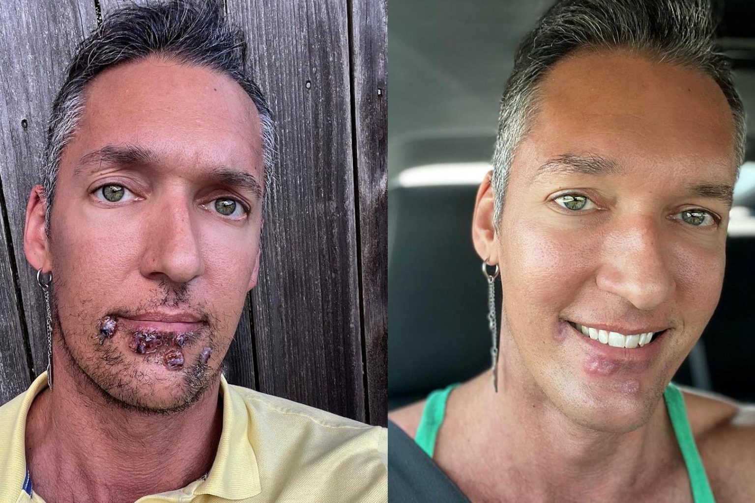 Six Big Questions About the Monkeypox Virus, Answered - Public Health